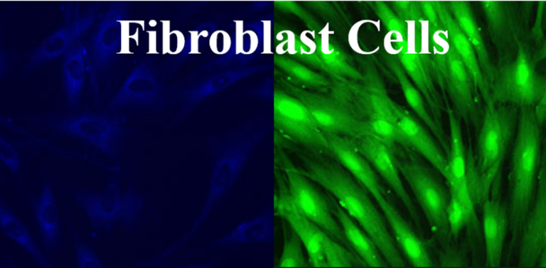 Fibroblasts - Structure and Function of Fibroblast Cells